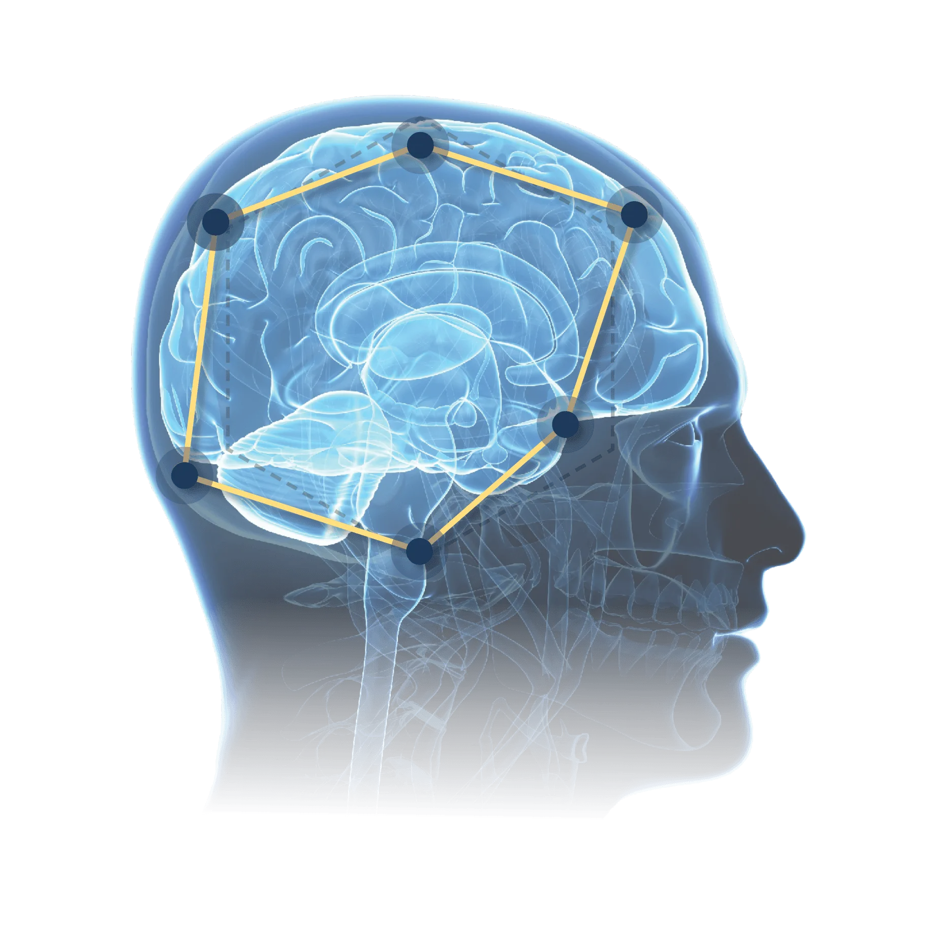 Home - NeuroCatch
